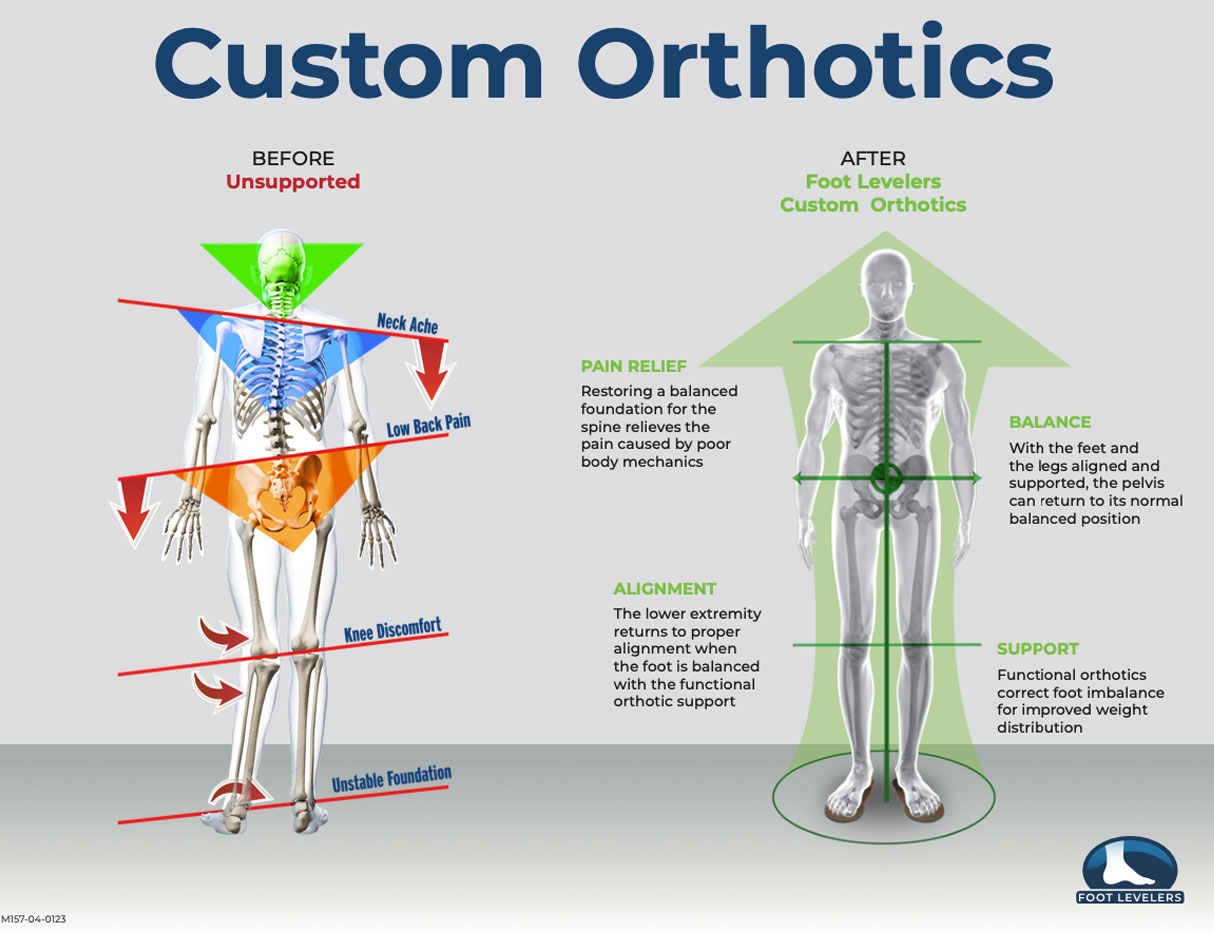 Foot Levelers - Monahan Chiropractic Medical Clinics